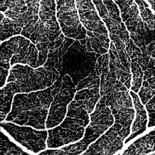 RNP Instance Segmentation Dataset and Pre-Trained Model by ENP