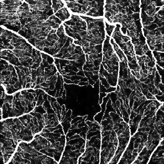 enp Instance Segmentation Dataset by ENP