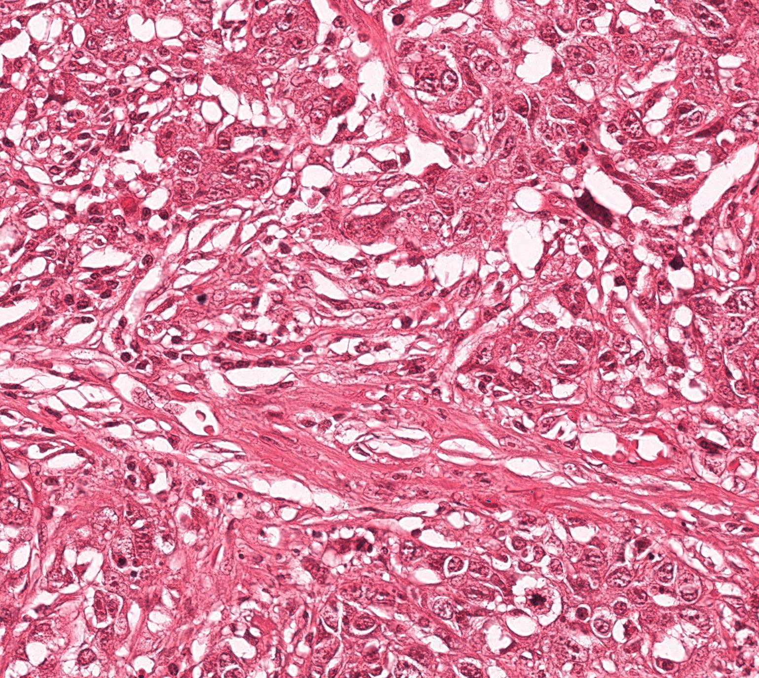 Mitosis Object Detection Dataset by Anand H