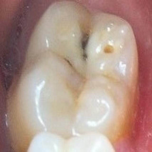 tooth Object Detection Model by Idan8