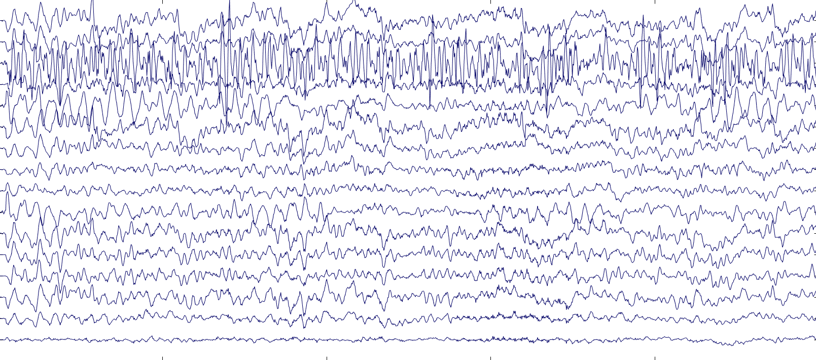 EEG_DataSet_P_N Classification Dataset by test
