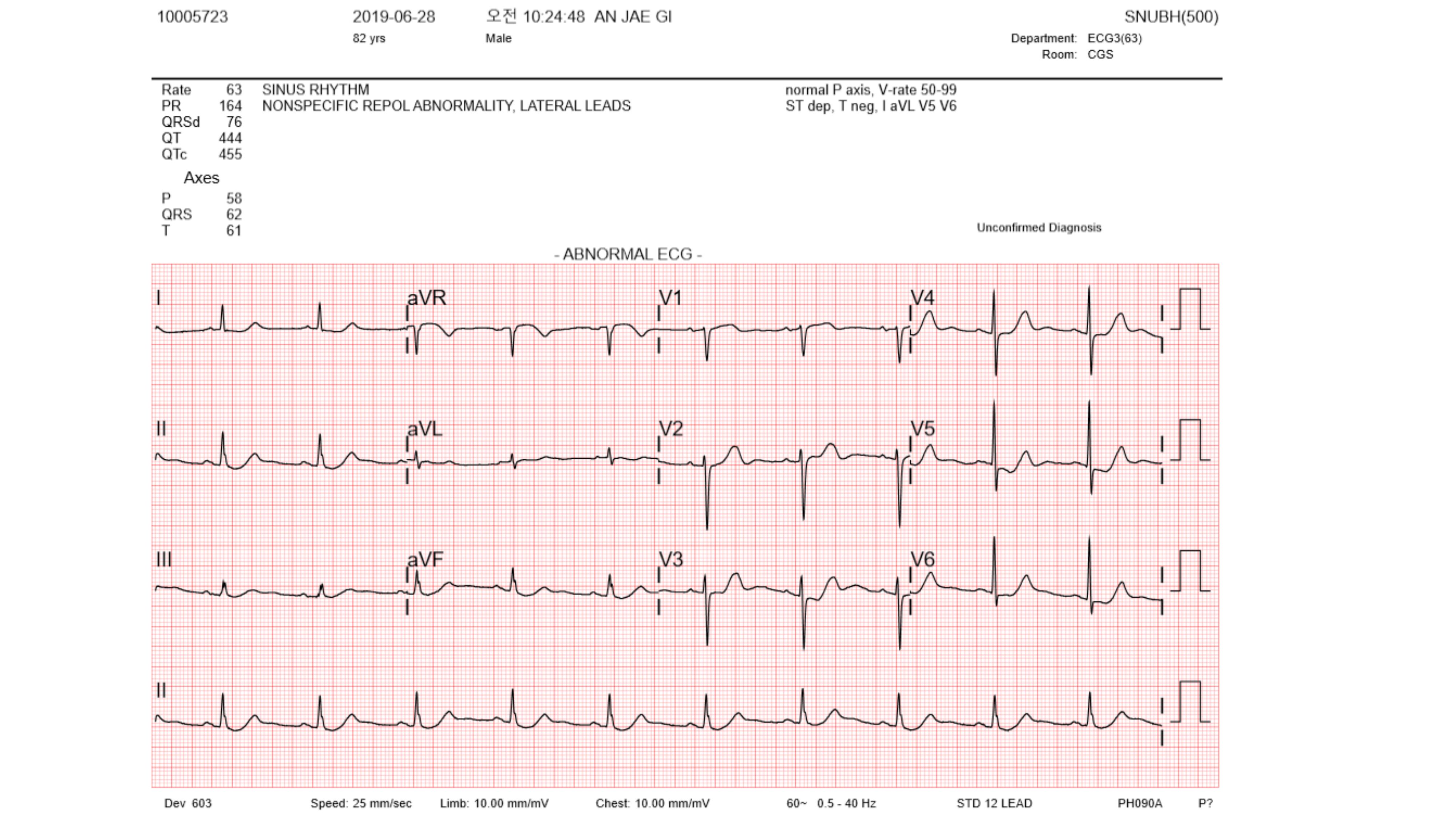 normal/abnormal-detection Object Detection Dataset and Pre-Trained Model by ssun