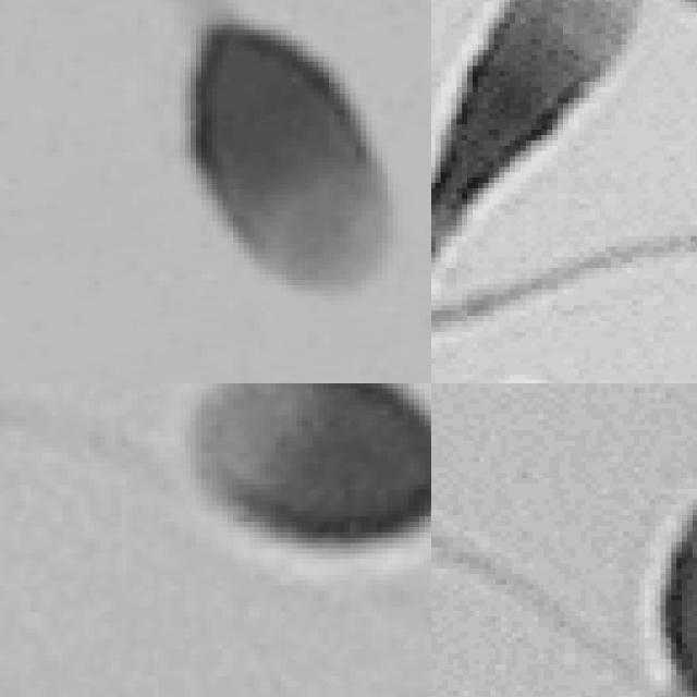 Sperm Detection Object Detection Dataset And Pre Trained Model By Thammasat University