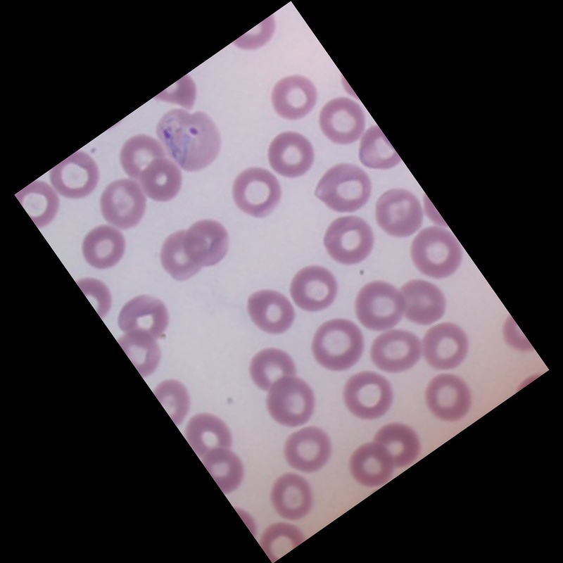 Top Ovalet Datasets and Models | Roboflow Universe