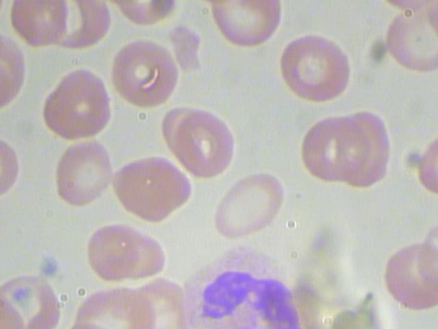 Blood Cell Classifier Object Detection Model By Mybloodcell
