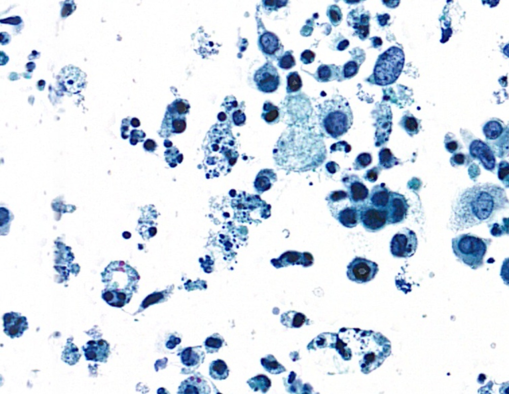 How to Use the Urine cytology image Object Detection API