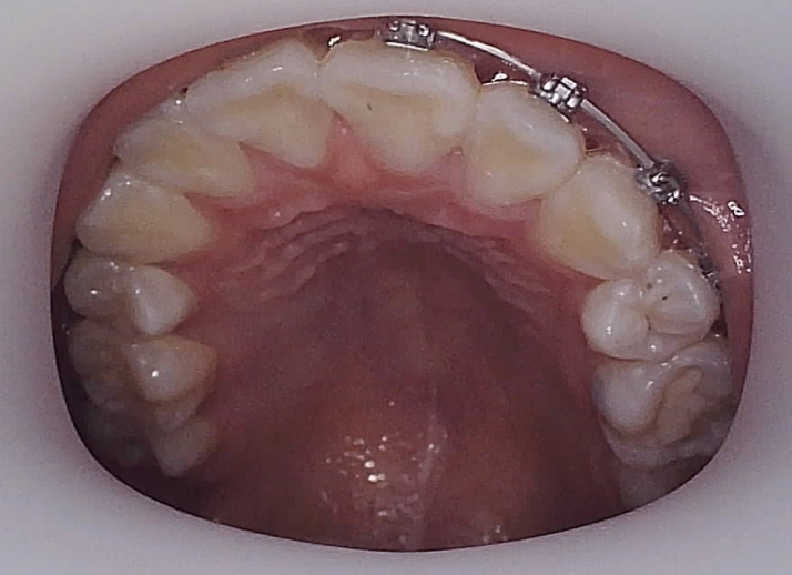 tooth-photo-check-6.7 Classification Model by Dental Examination