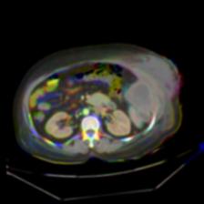 liver tumer classification Object Detection Dataset by Engineer of Baghdad