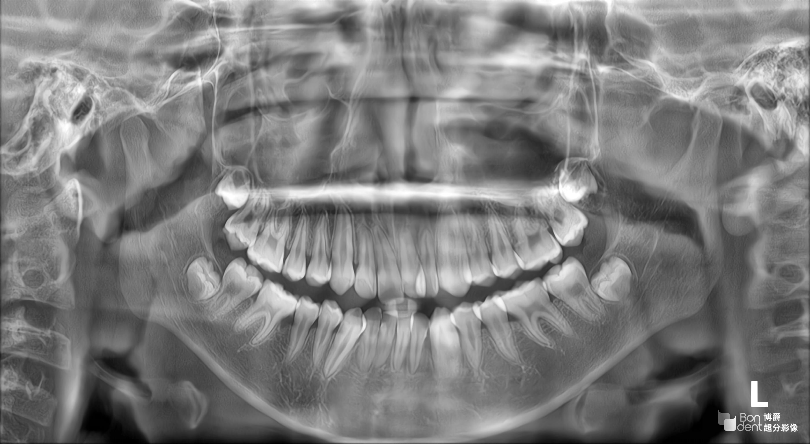 tooth Object Detection Dataset by tooth