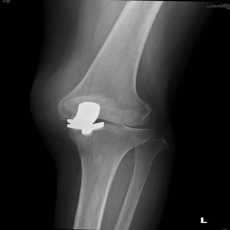 rotation Classification Dataset by project-exykj