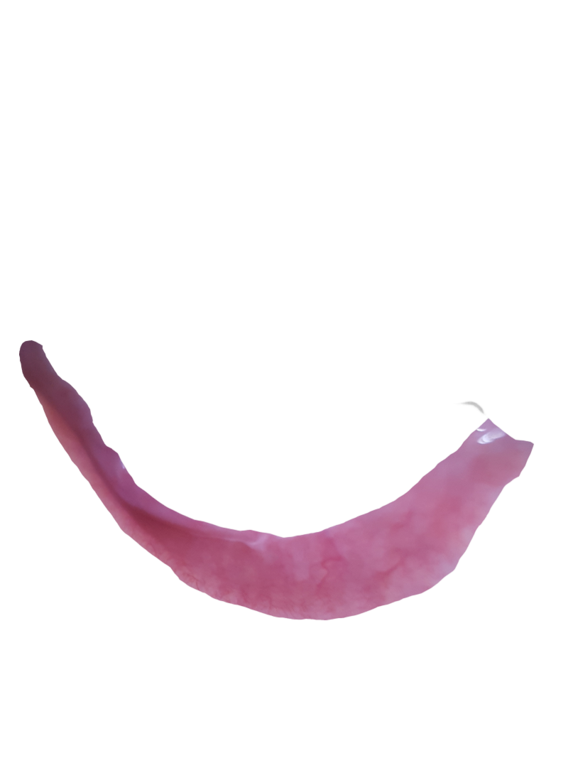 anemia detection filter hapus BG Classification Dataset by skripsi anemia