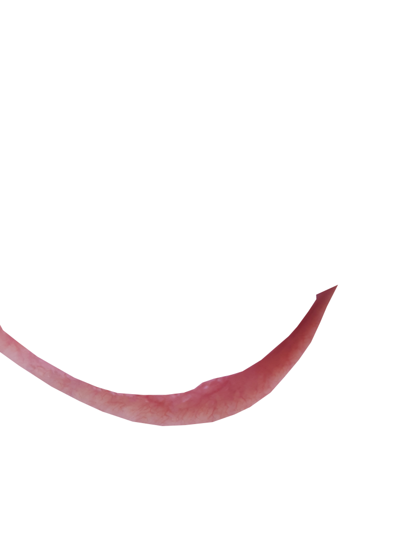 Anemia Detection Classification Dataset And Pre Trained Model By