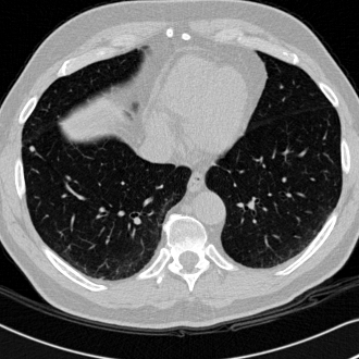 fads Object Detection Model by gjioergw