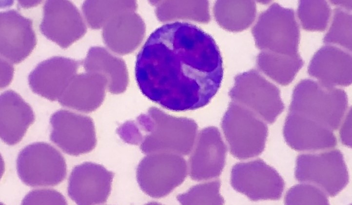 Cell-Segmentation Instance Segmentation Dataset and Pre-Trained Model by anna