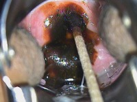 Proyecto especial - Roboflow Universe