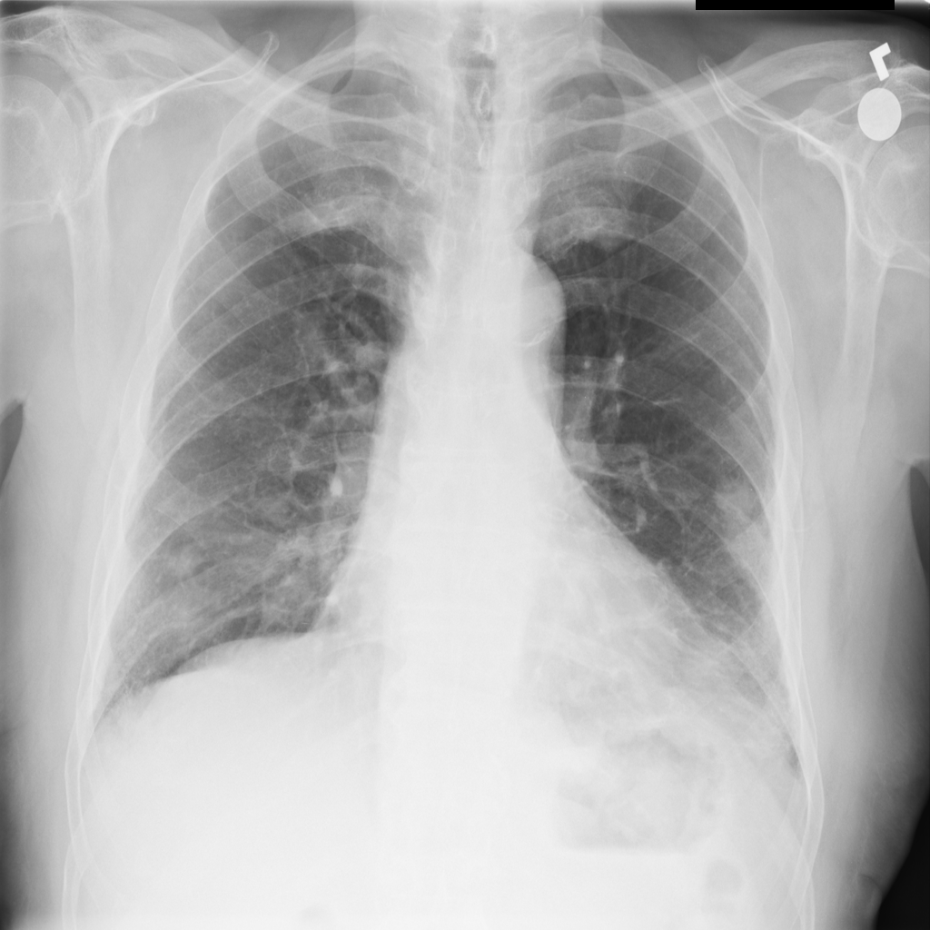 Xray Classification Model by DooWon Lee