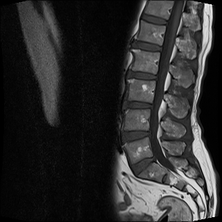 Lumbar Instance Segmentation Model by Faro