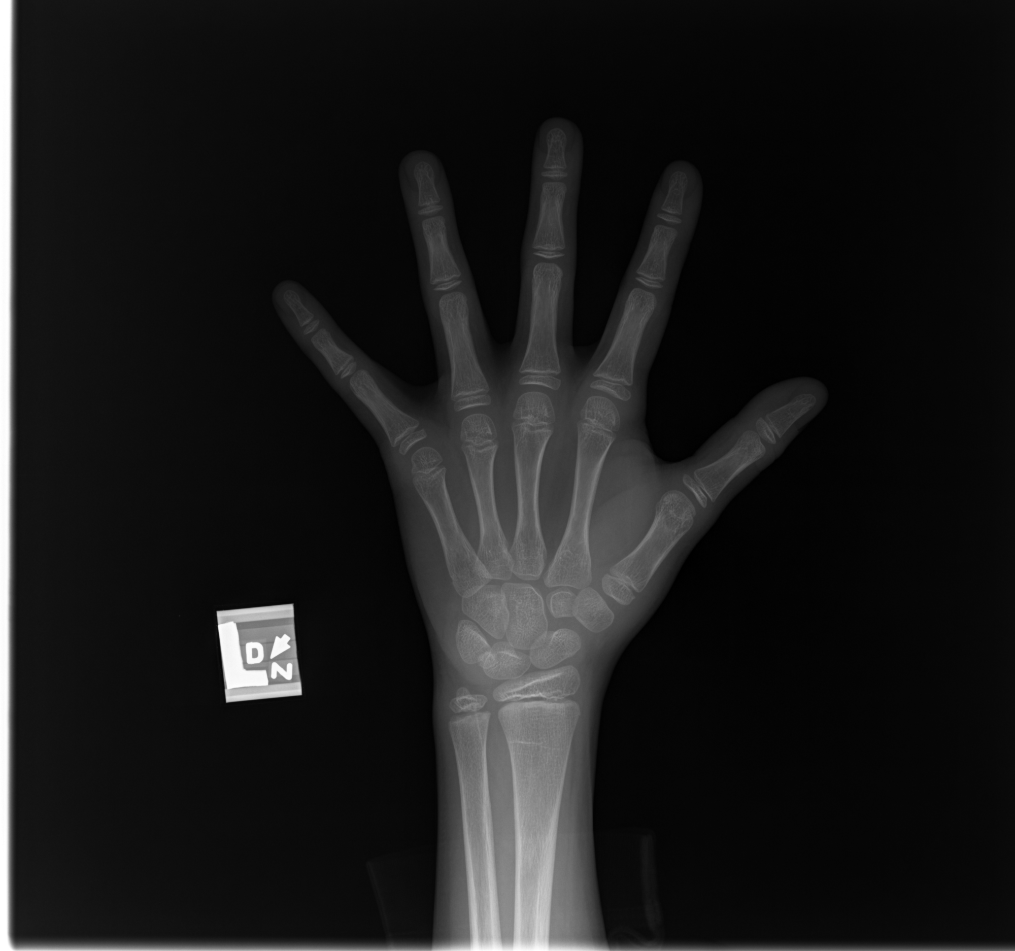 joints-5 Object Detection Dataset by joints5