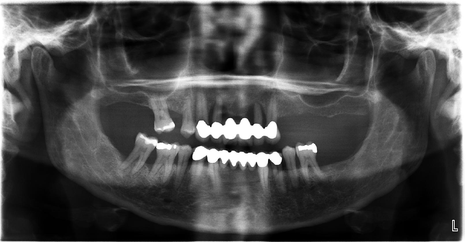 How to Use the Radiografia Panoramica Lector Instance Segmentation API