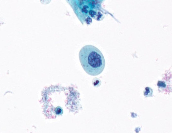 cervical_cancer_cells Object Detection Model by workspace