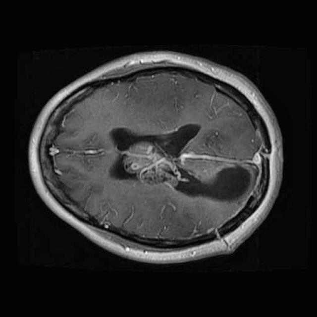 Medical_seg Instance Segmentation Dataset by calculayor