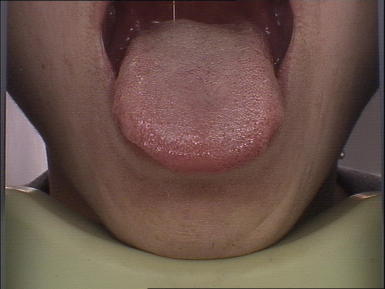 Tongue Detection Semantic Segmentation Model By Tongue Detect