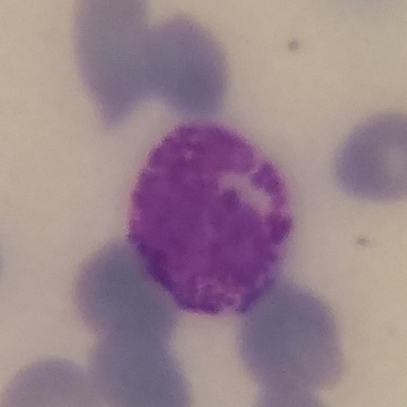 LCBSI-DS Classification Model by LCBSIWBC