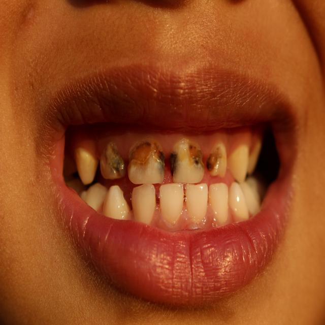 Teeth Instance Segmentation Dataset by Data Science