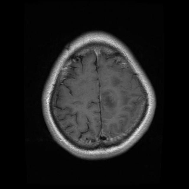 Brain Tumor Detection Object Detection Dataset and Pre-Trained Model by ... Brain Tumor Detection Object Detection Dataset and Pre-Trained Model by ...