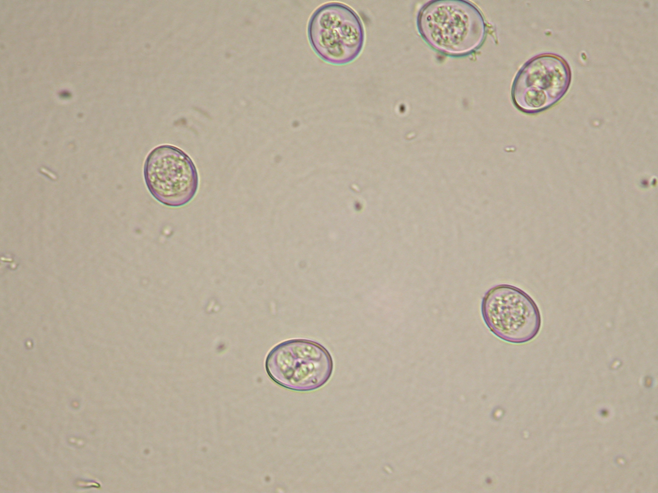 2025-04-19 FP - Type 01 Object Detection Dataset by Shooq Object Detection