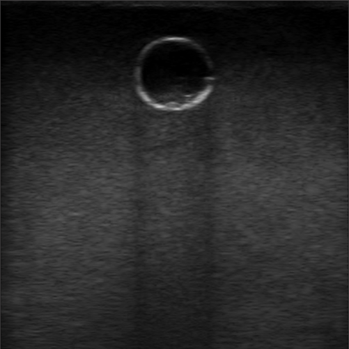 laraa - Roboflow Universe