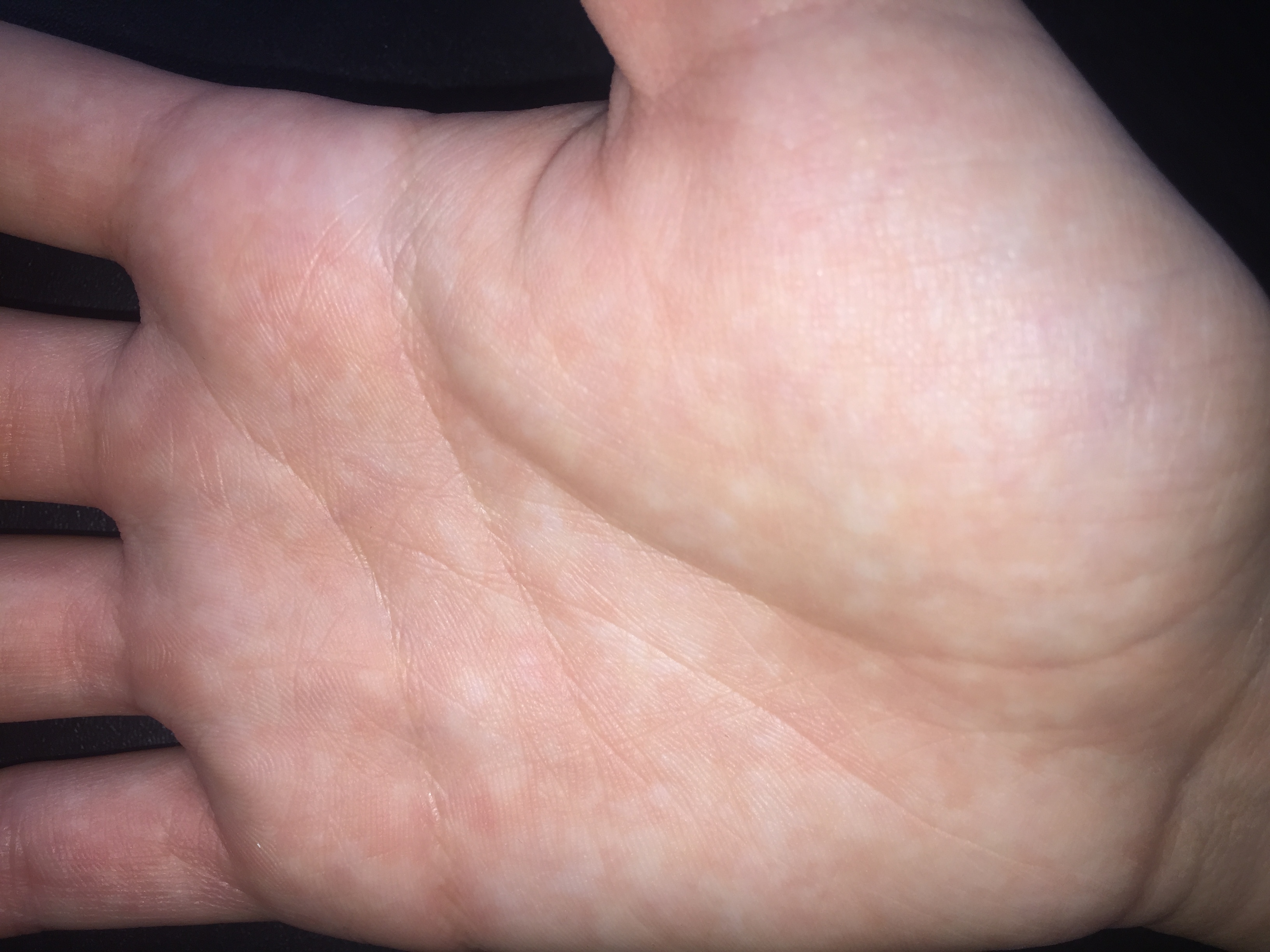 Life Line classification Instance Segmentation Dataset and Pre-Trained Model by Fontys