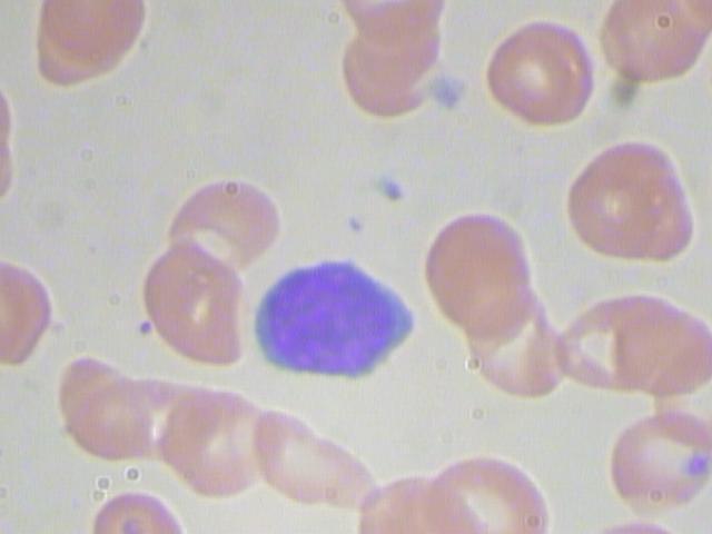 Test blood cell count and detection Object Detection Dataset by learningml