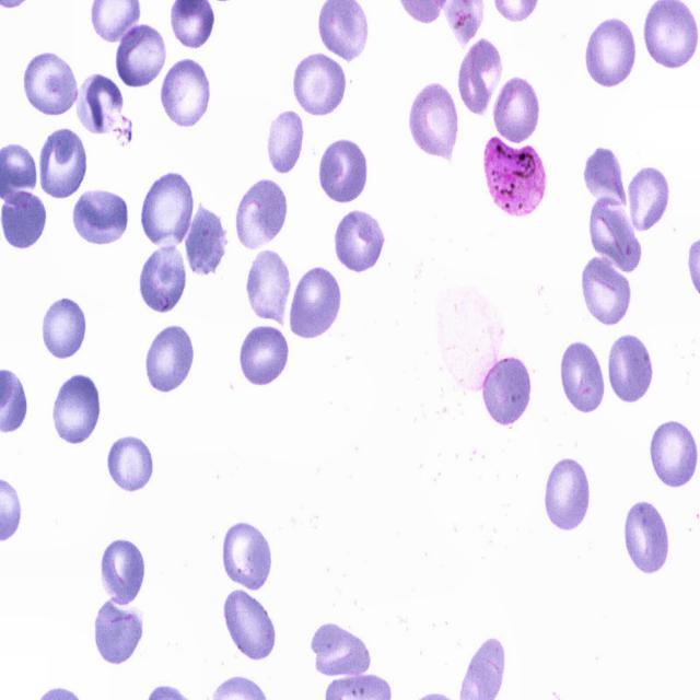 malaria_yolo Object Detection Model by malaria