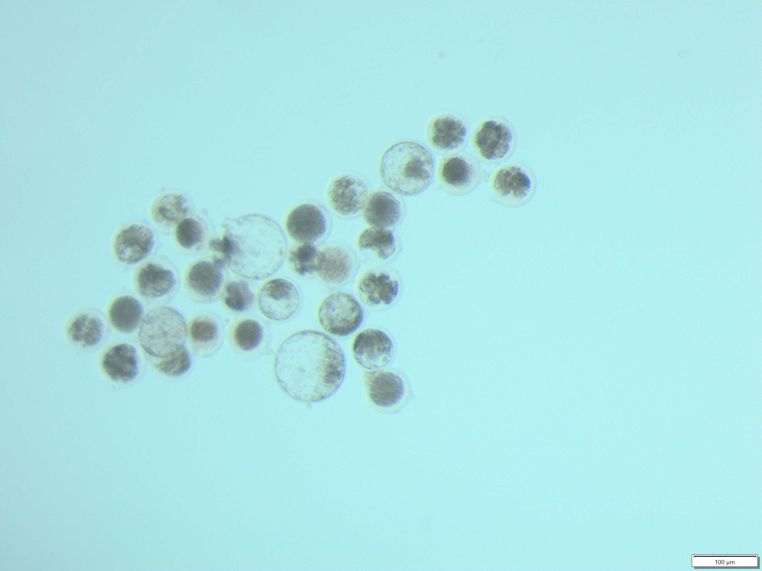 First test_LC Instance Segmentation Model by Segmentao