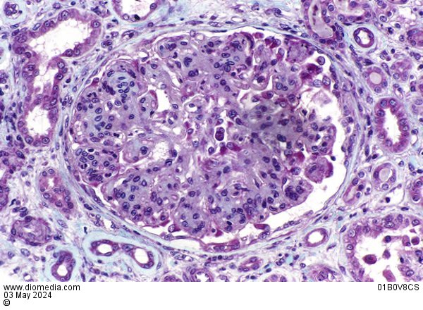 Kidney Classification Model by Project Kidney
