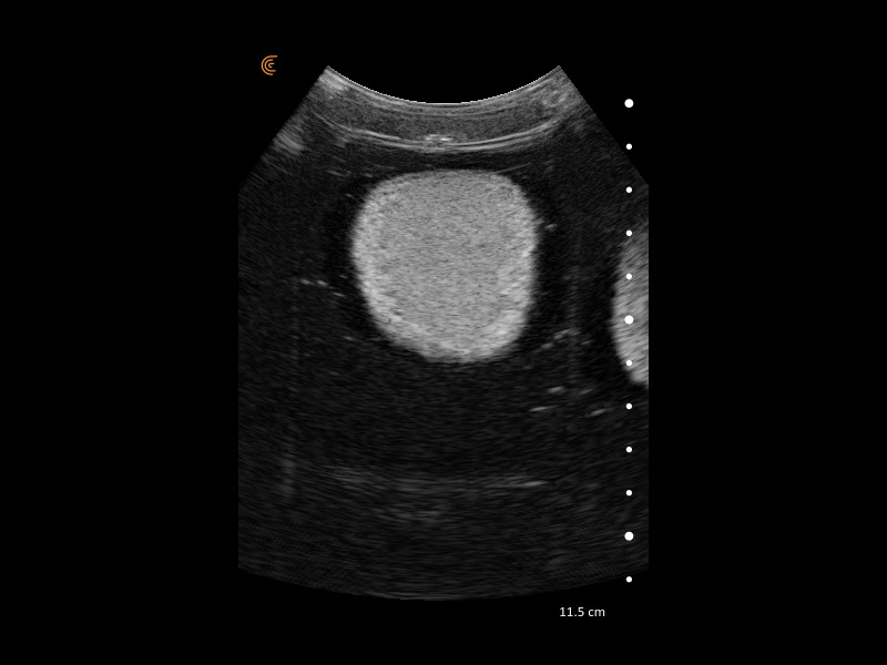 Phantom Object Det. Object Detection Dataset by Prostate Ultrasound