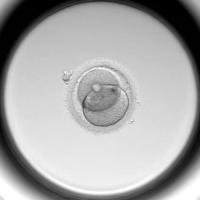 oocyte semantic Semantic Segmentation Dataset and Pre-Trained Model by semantic oocyte