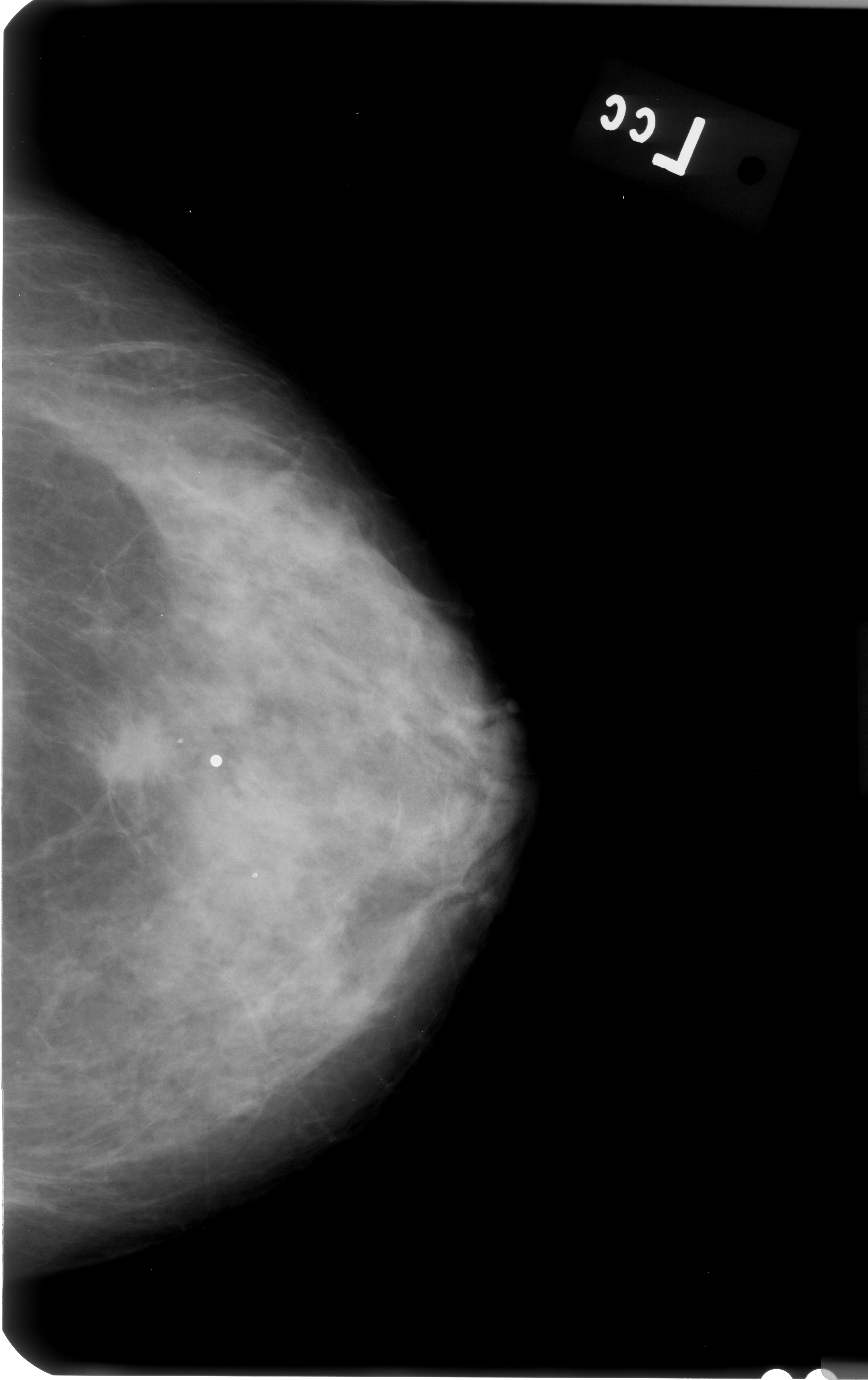 classification-of-cbis-classification-dataset-by-dboflina44