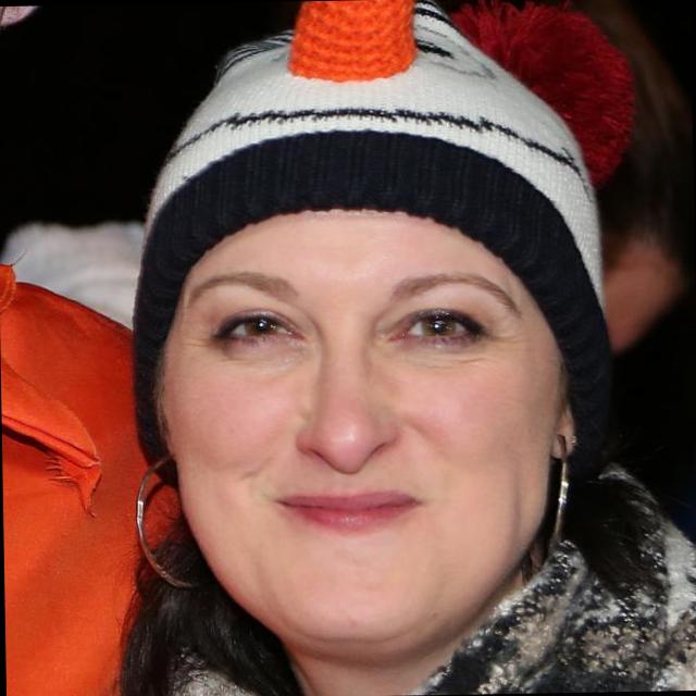 Face Wrinkles Detection Instance Segmentation Dataset by Yolov7