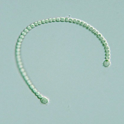 Algae DeTect Object Detection Dataset by Algae Classification YOLO