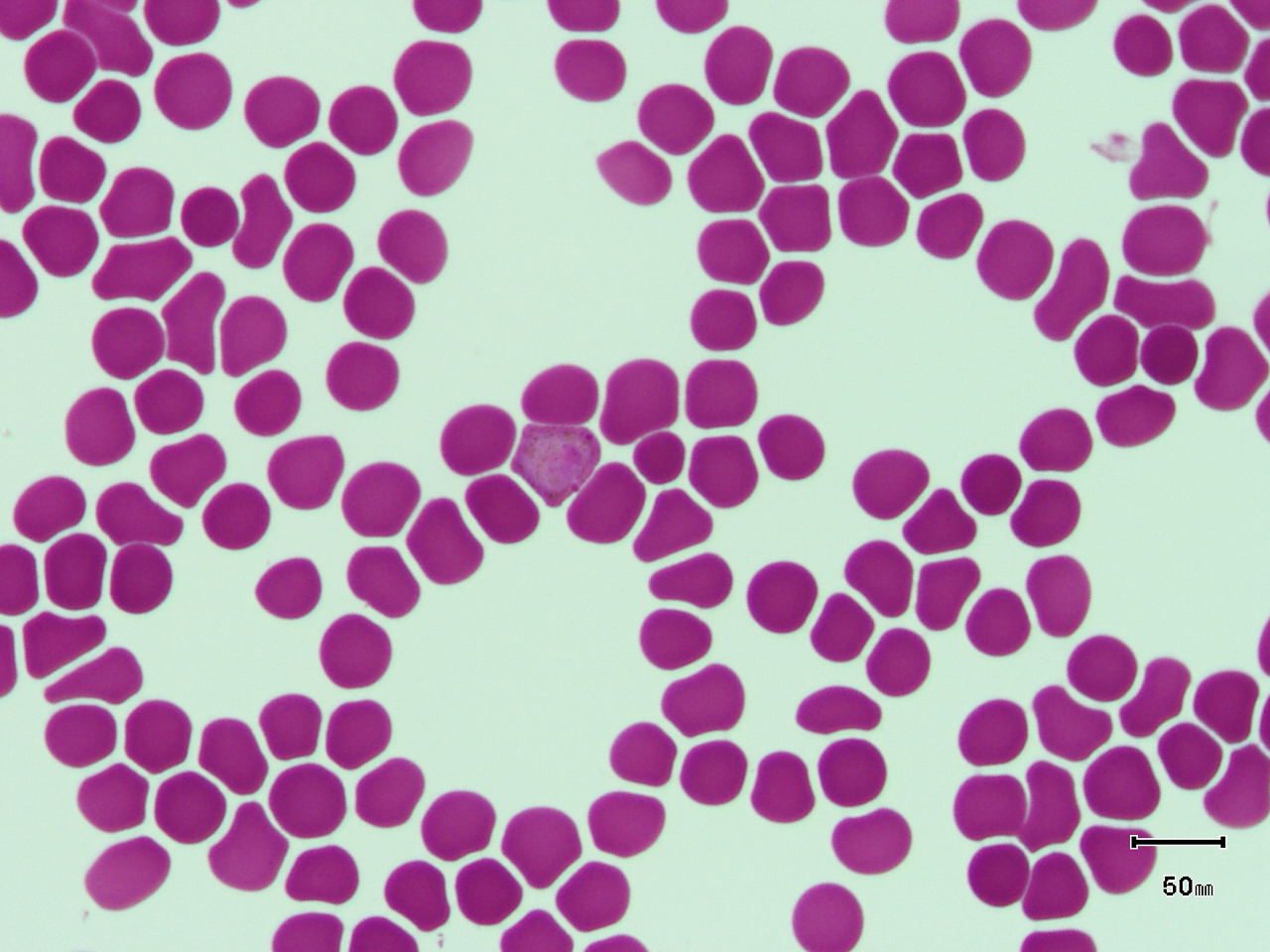 Malaria Detection Object Detection Dataset By Uea