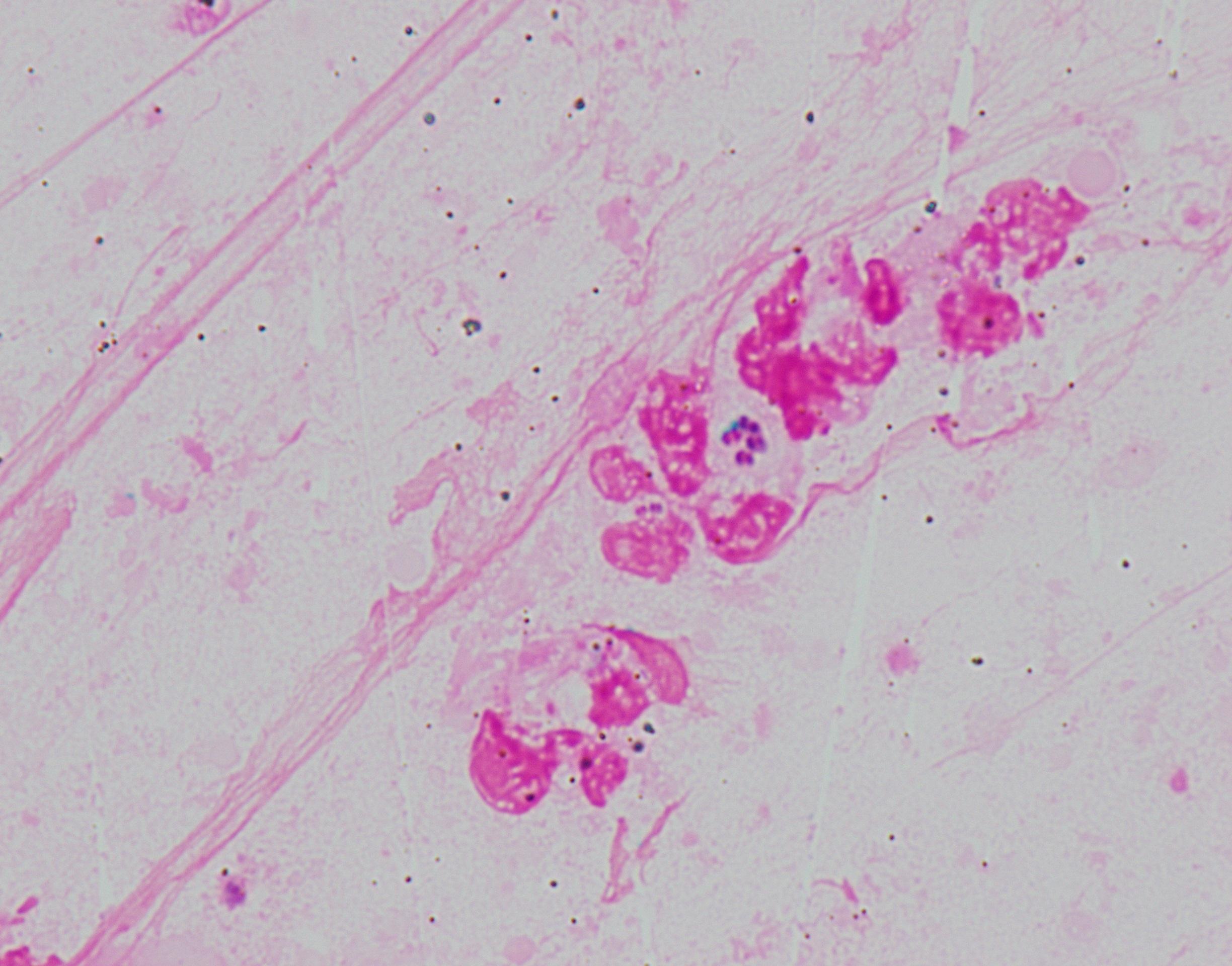 new-WBC3-6-2-2_*6 Object Detection Dataset by Leukocyte