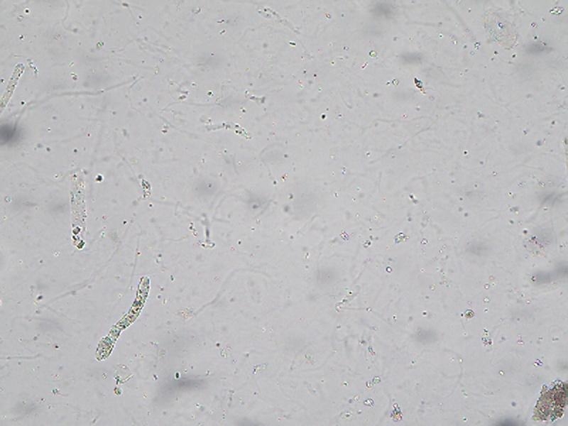 urine-analysis1-q0uii-fsod-lwit Object Detection Dataset by ...