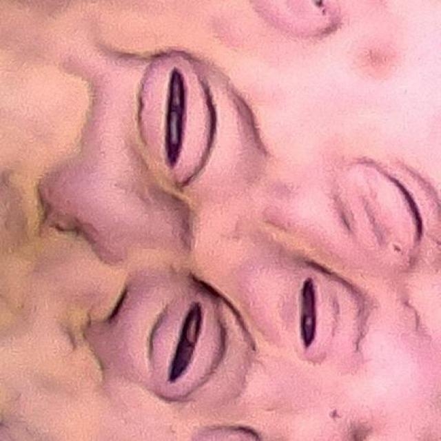 Stomata Cells Fsod Qjhp Object Detection Dataset By Roboflow100vl Fsod