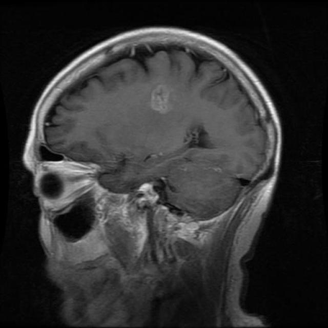 Object Segmentation 2 Instance Segmentation Dataset And Pre Trained Model By Shofiagh