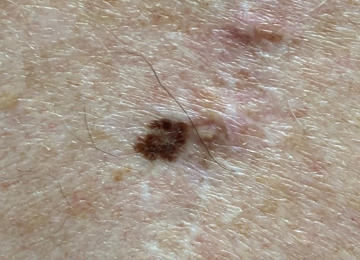 Rida project - Roboflow Universe