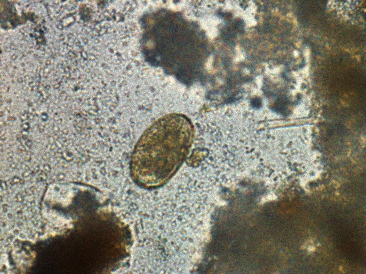 PinwormEggs Object Detection Model by BMI assignment