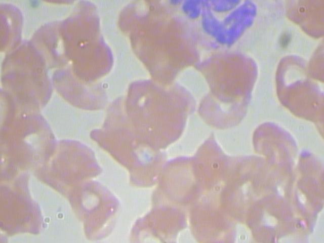 Blood Classification Object Detection Model by ECE695 project