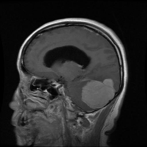 Mri Object Detection Dataset by tks stuff